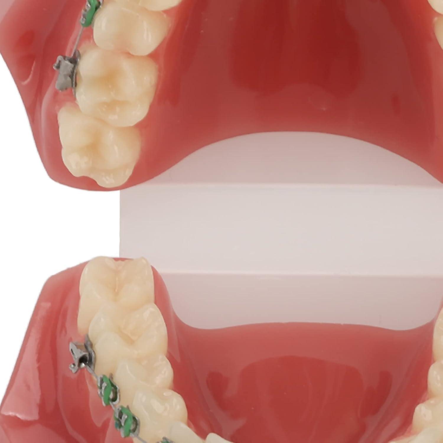 Portable Orthodontic Bracket Model - Simulated Safe Dental Resin for ...