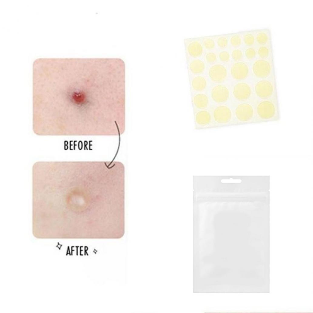 Connoworld 24 Patches Beauty Acne Patch Set - Pimple Treatment and ...