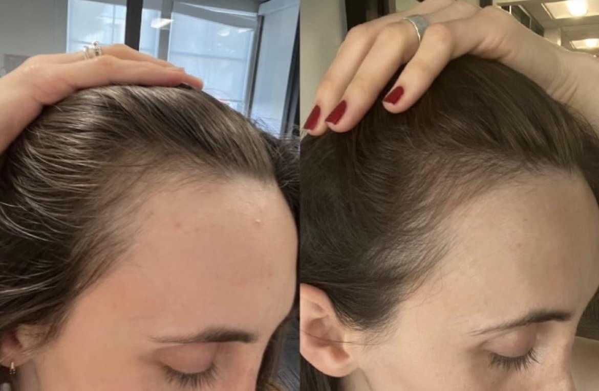 BUR BUR Growing Season Hair Growth And Repair Oil with Burdock, Nettle ...