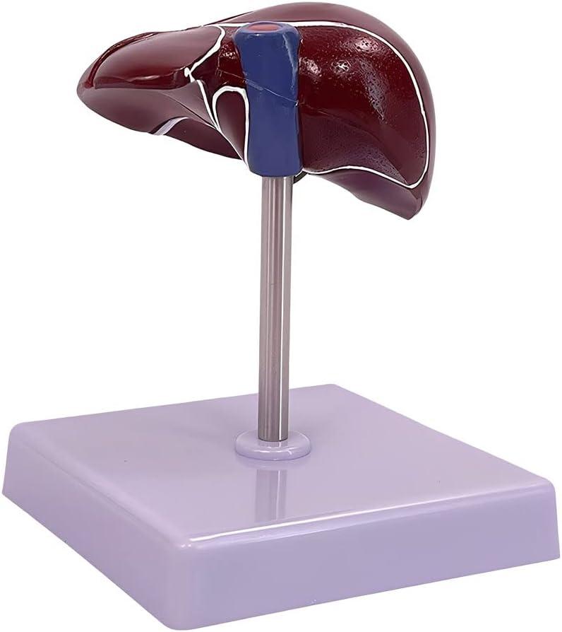 ARAZI Human Liver Pathology Model Visualization of Liver Lesions Clear ...