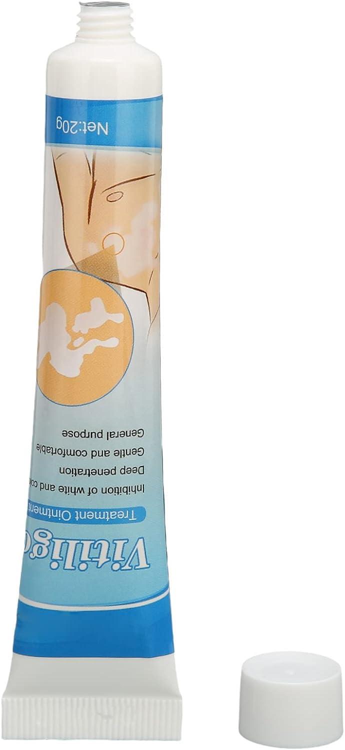 Vitiligo Treatment Cream 20g - Herbal Extract for White Spots & Skin ...