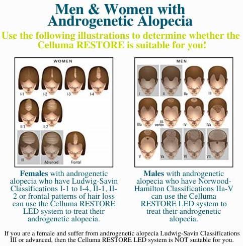 Celluma Restore: Hair Regrowth, Anti-Aging, and Pain Relief Device ...