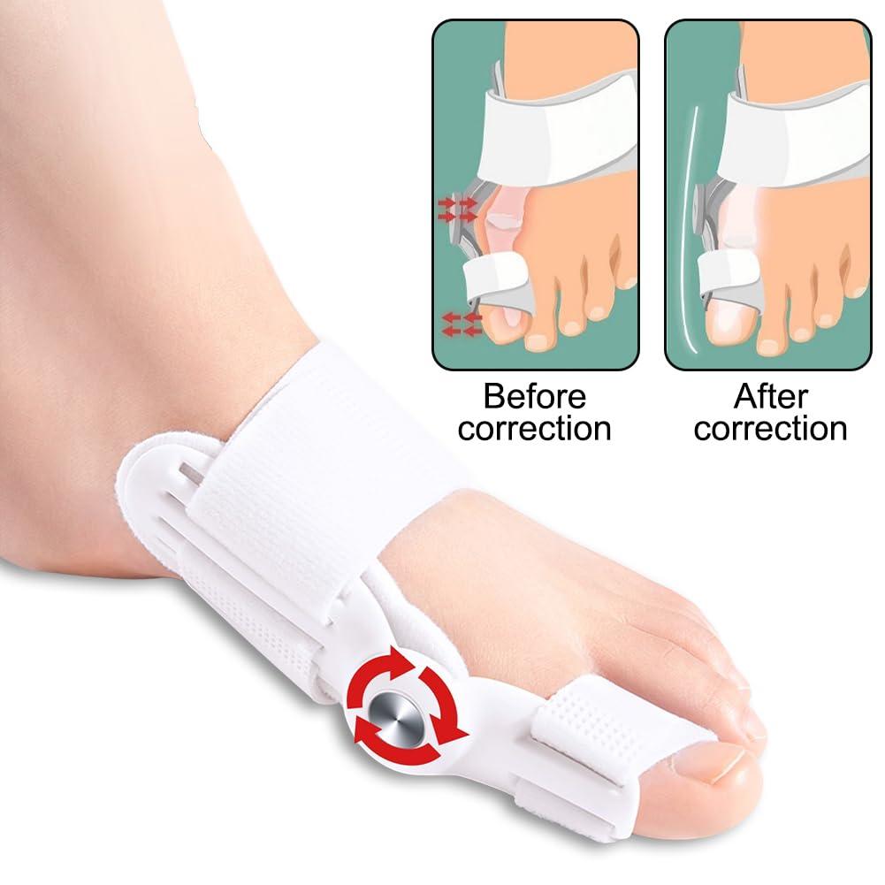 Hallux Valgus Correction Set - Adjustable Rail for Big Toe Relief ...
