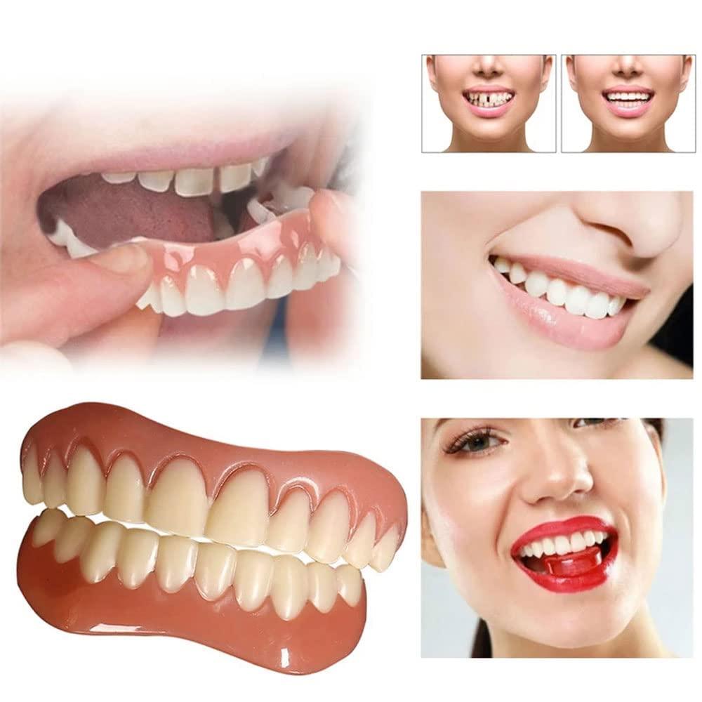 Veneer Dentures for Men and Women - Natural Shade, Easy At-Home Smile ...