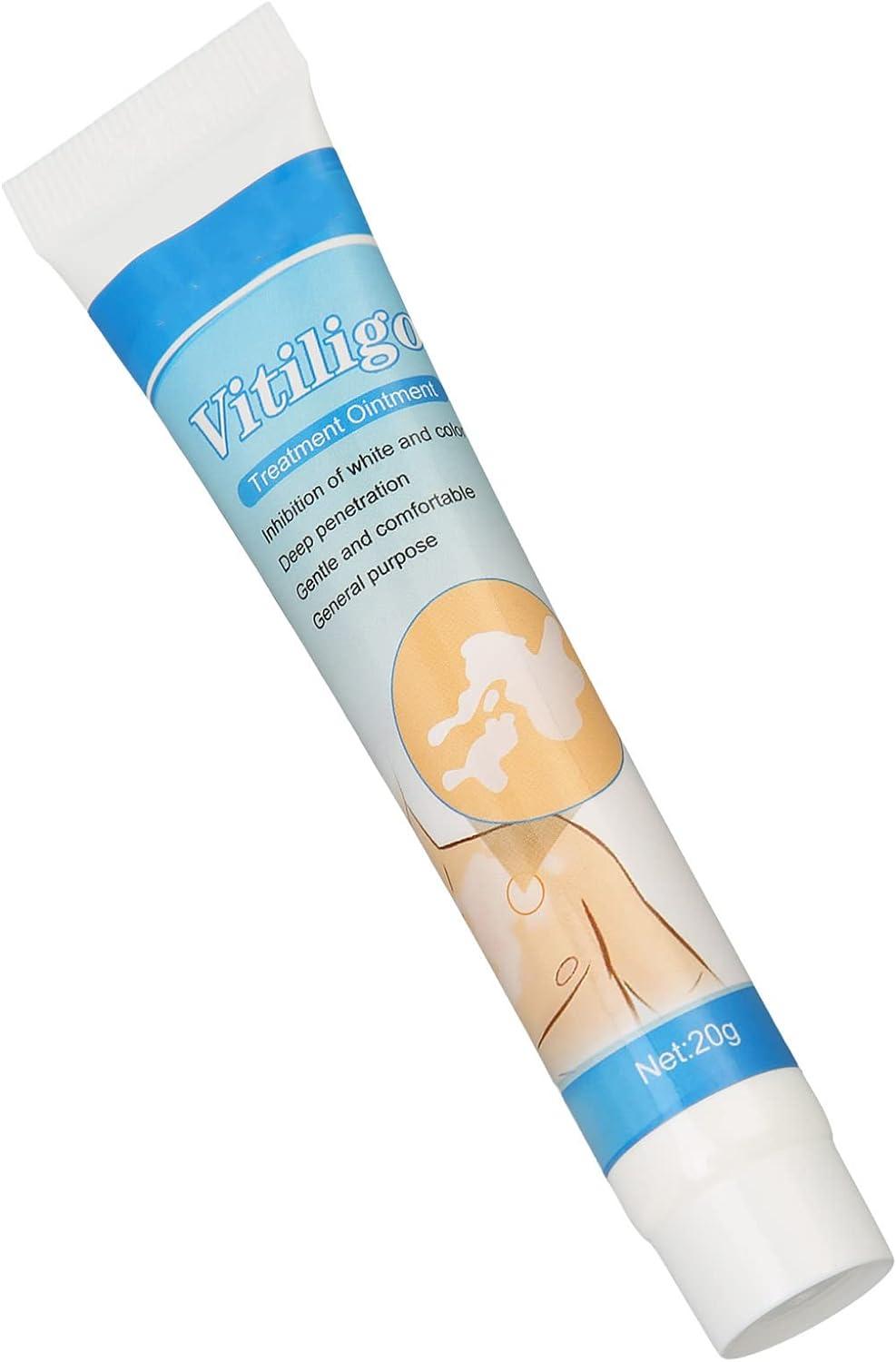 Vitiligo Treatment Ointment Cream 0.7 Oz - Improve Skin Pigmentation ...