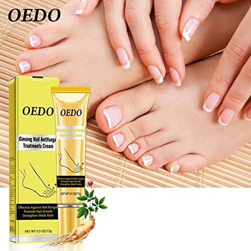 OEDO Anti-Fungal Cream - 15g Relief for Itchy Cracks & Scaly Skin ...