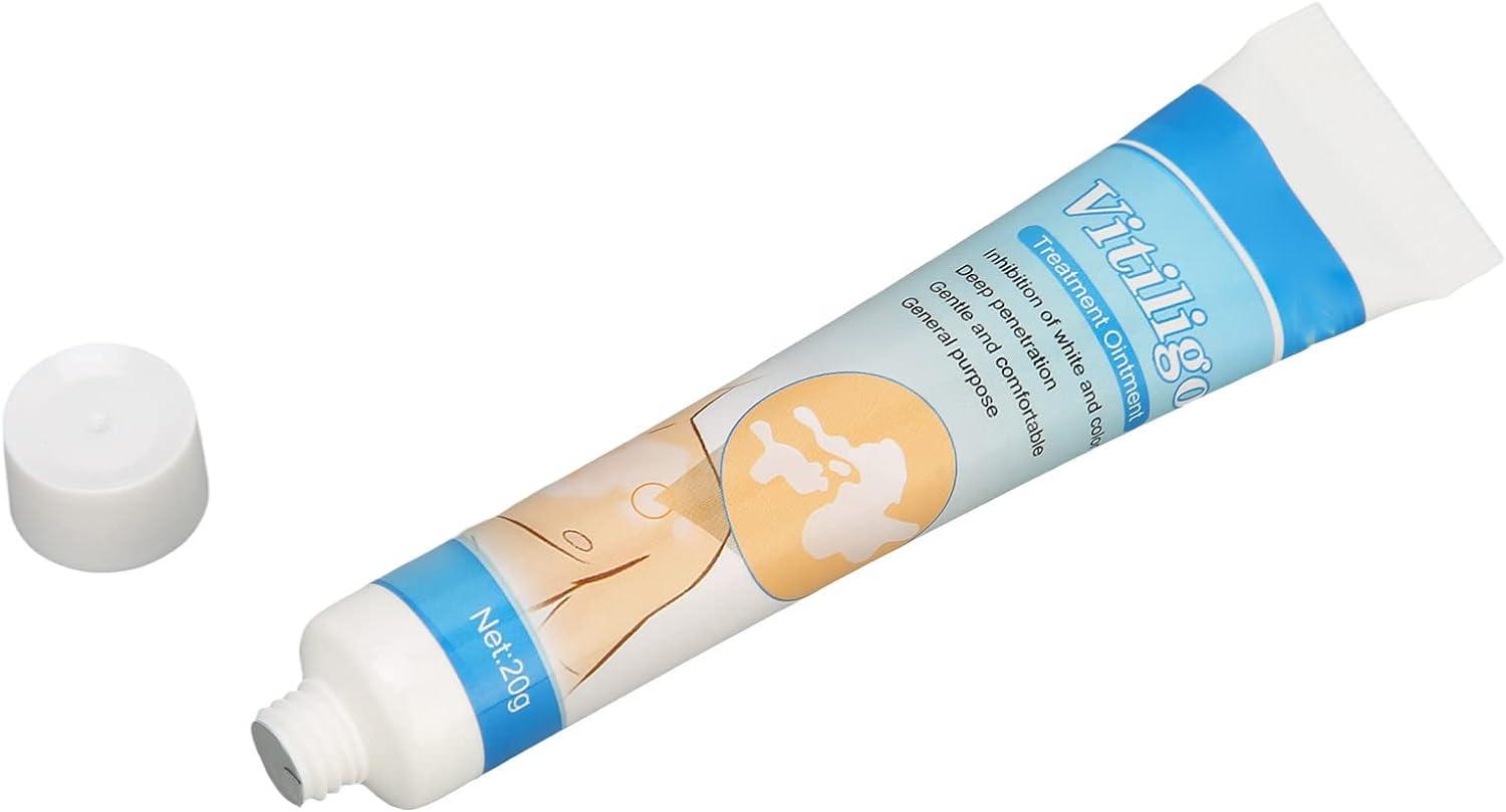 Vitiligo Care Cream - Herbal Extract for Skin Pigmentation & Psoriasis ...