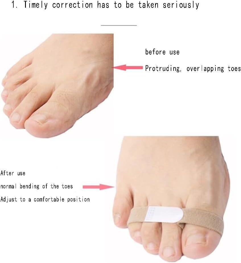 Buy Hammer Toe Rails & Fabric Splints - Toe Dividers & Adjustable Bands ...