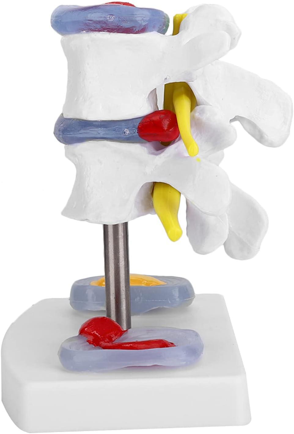 Anatomical Lumbar Intervertebral Disc Model - Spine Demonstration for ...