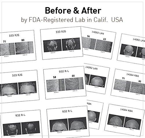 Dr Ross' BIOGEM Hair Loss Care Set - Shampoo & Conditioner 10oz ...