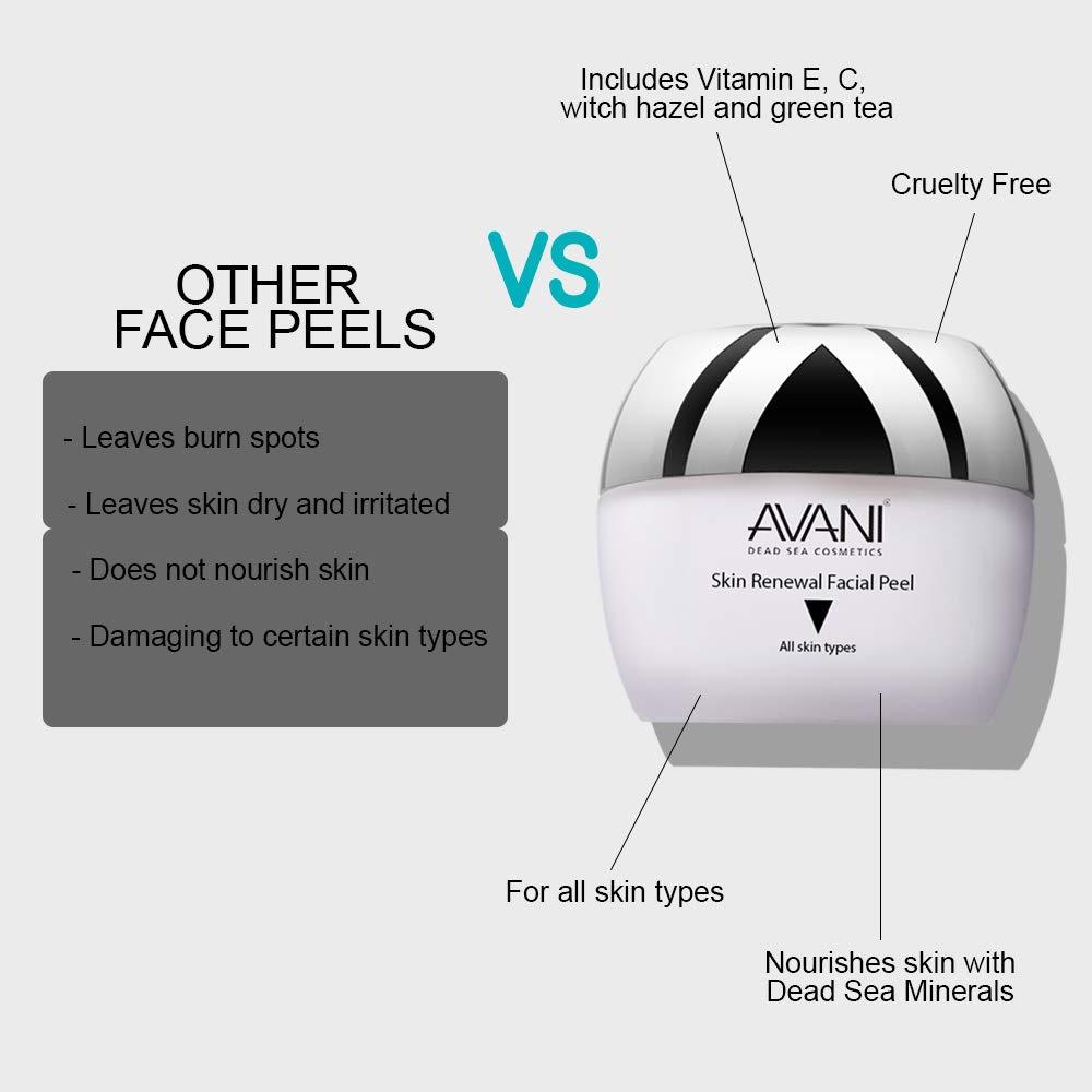 Avani Classics Skin Renewal Facial Peel - Brightening & Anti-Aging ...