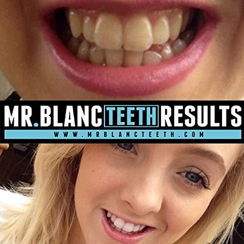 Mr Blanc Teeth Pro Whitening Toothpaste 100ml | Buy Now for Bright ...