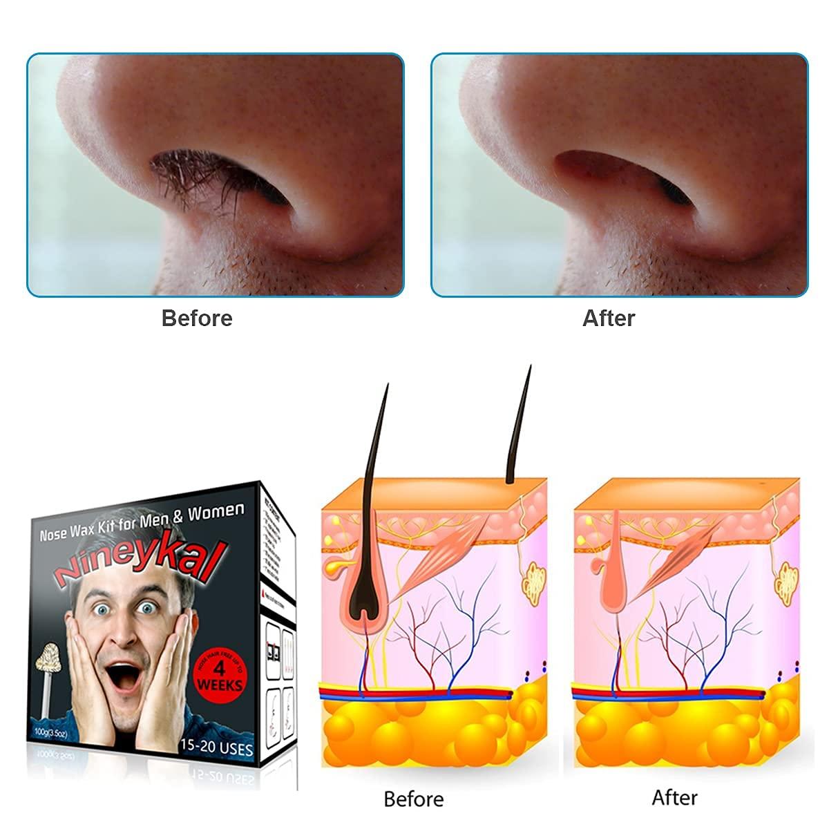 Nose Wax Kit 100g with 30 Applicators | 15-20 Uses | Includes 10 After ...