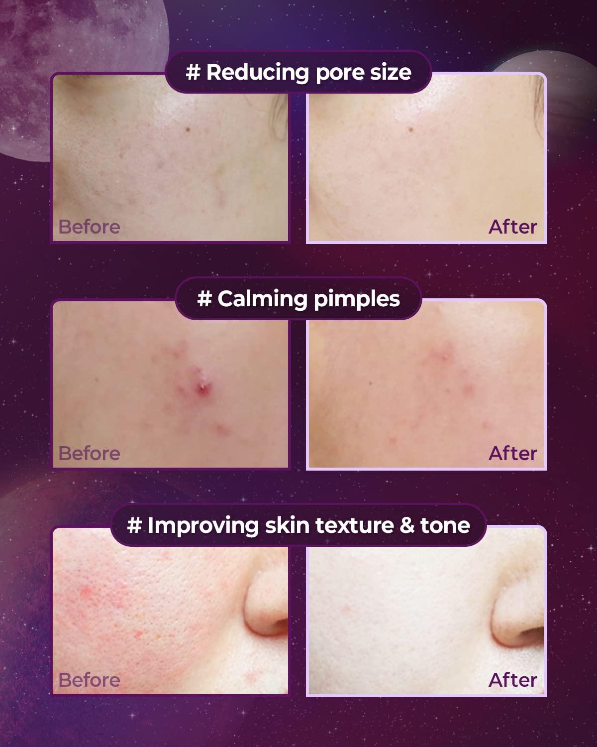 CRAZY SKIN Repair Trouble Care Sleeping Cream 1.76oz | Deep ...