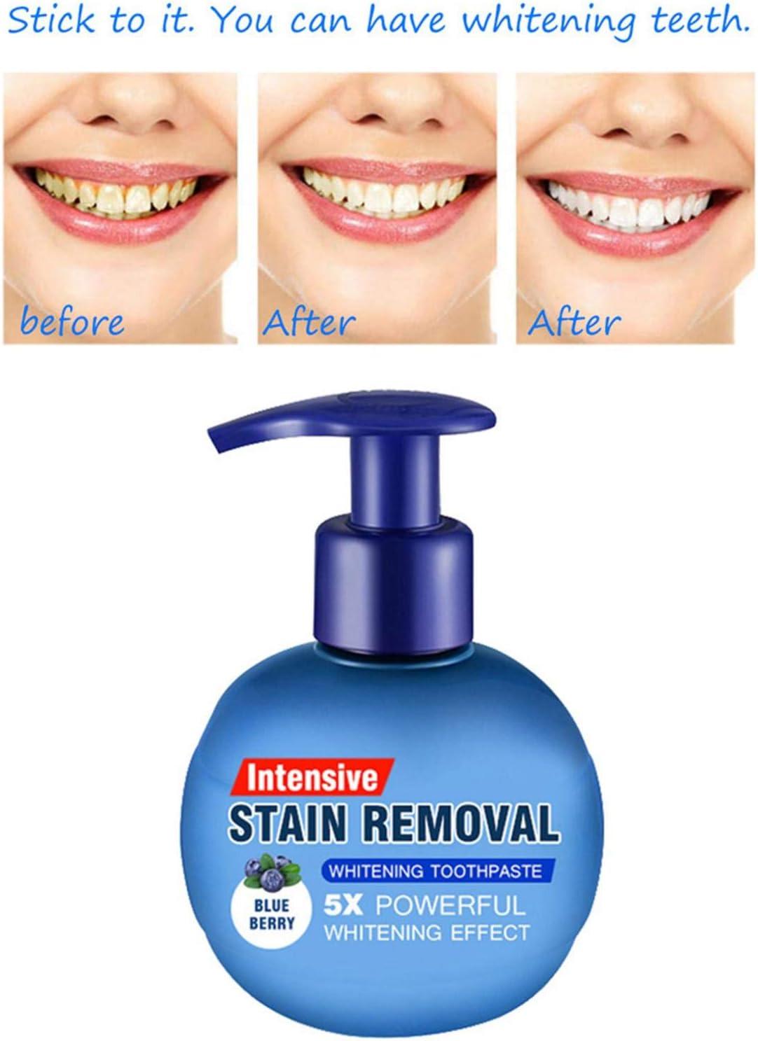Monshop Teeth Whitening Toothpaste - Effective Stain Removal for White ...