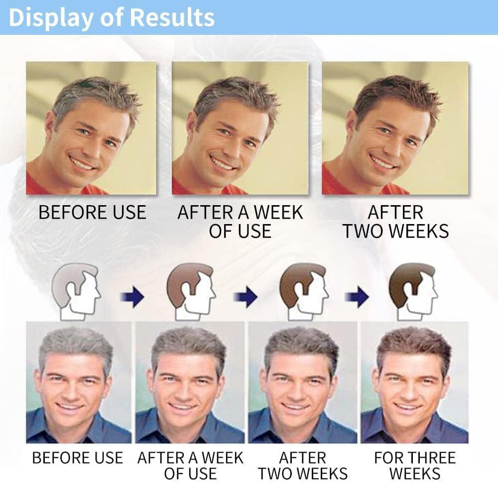 Restoria Discreet Colour Restoring Cream - 8.45 Fl.Oz. | Restore Hair ...