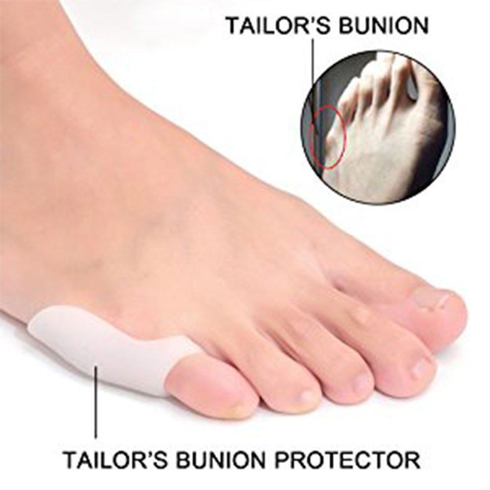 Pedimend Tailoring Bale Relief Gel Pads | Bunionette Corrector & Pinky ...