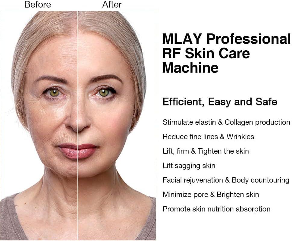 MLAY RF Skin Care Machine | Professional Skin Tightening Device with 3 ...