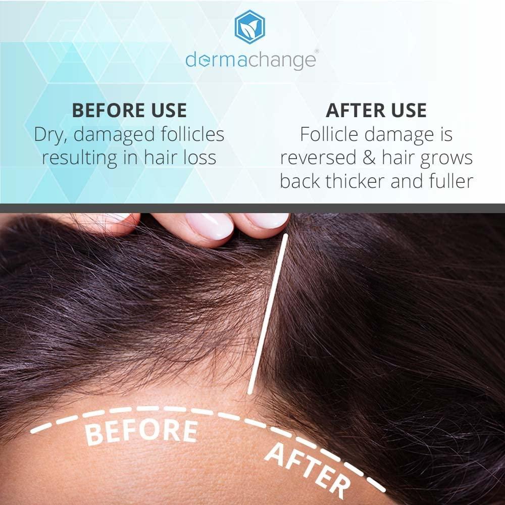 Sulfate-Free Hair Growth Shampoo for Thinning Hair - Volumizing ...