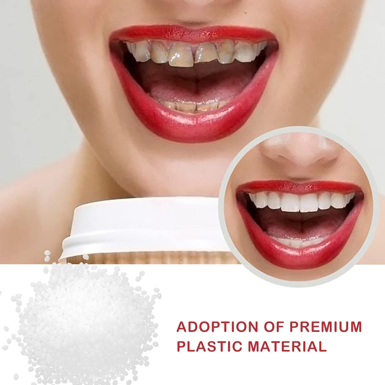 60g Temporary Dental Repair Set - Adhesive for Missing & Broken Teeth ...