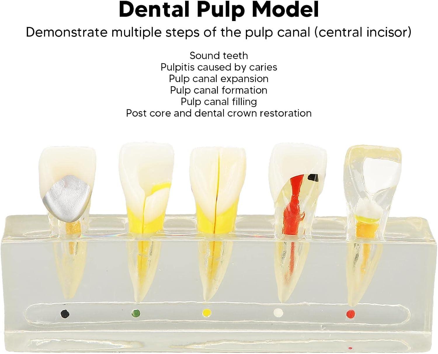 Endodontic Model - Stable Portable Dental Pulp Model for Practice ...