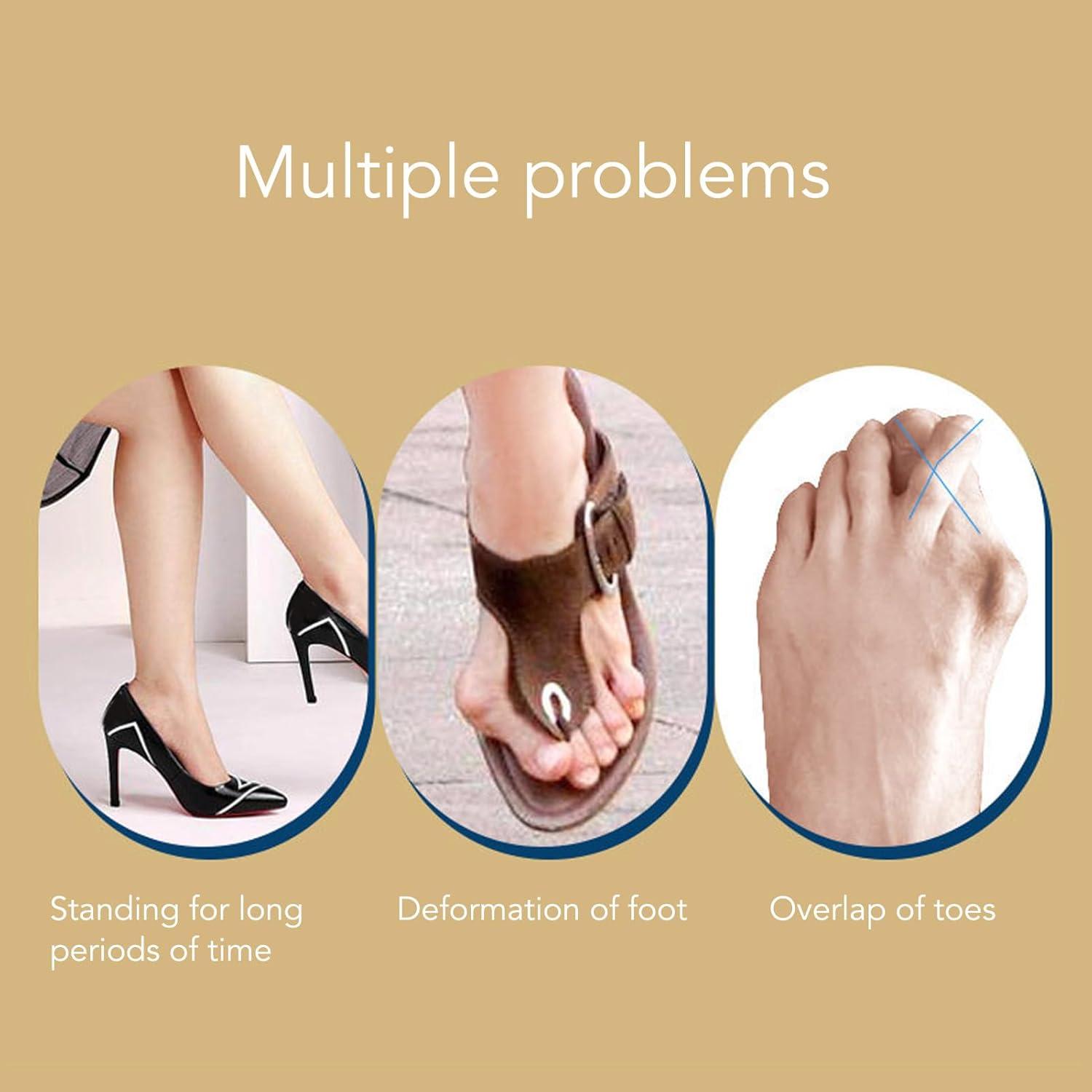 Hammer Toe Pillows - 3 Pairs of Medical Silicone Cushions & 2 ...