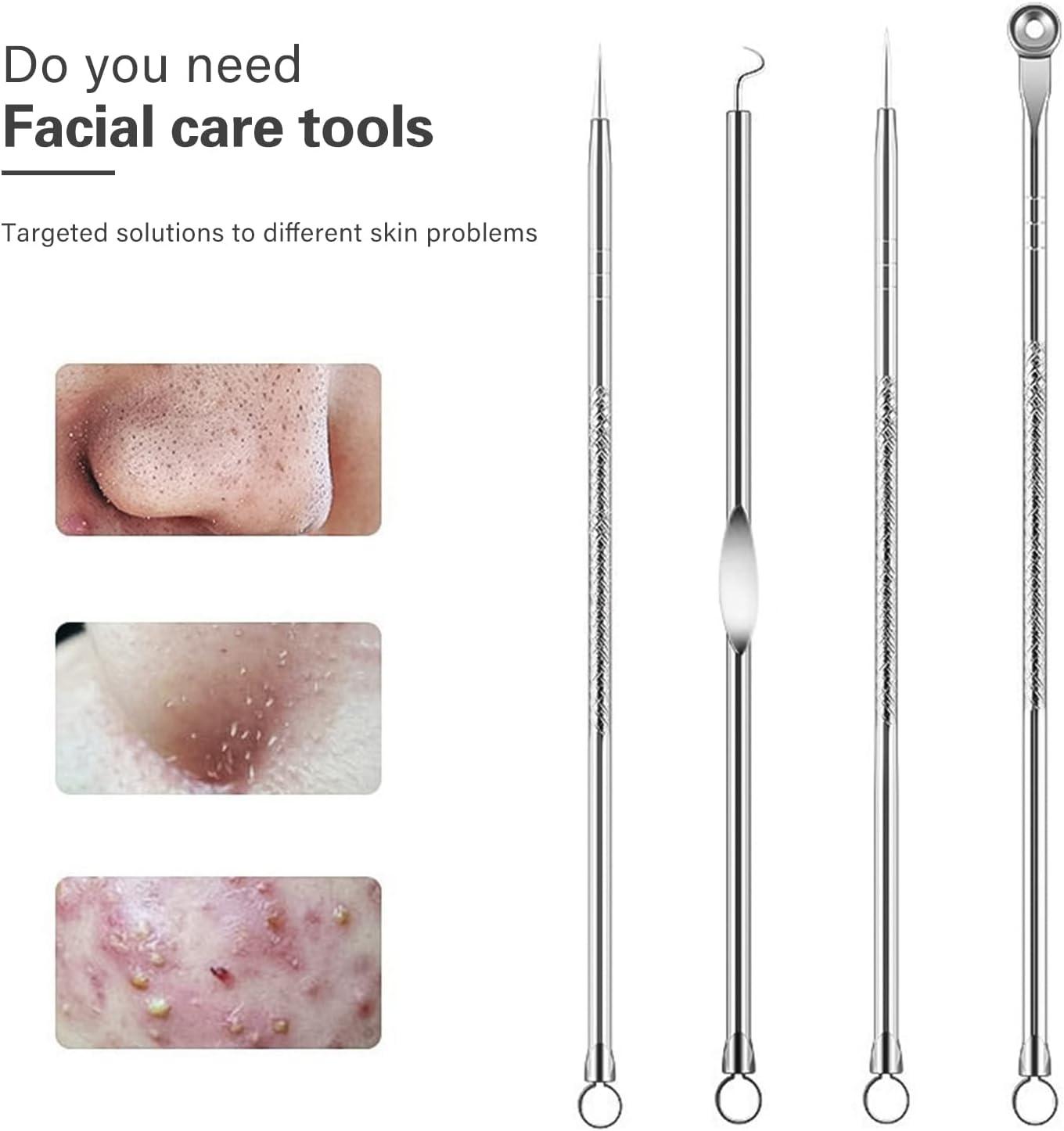 Blackhead Removal Tool Kit - Professional Stainless Steel Extractor for ...