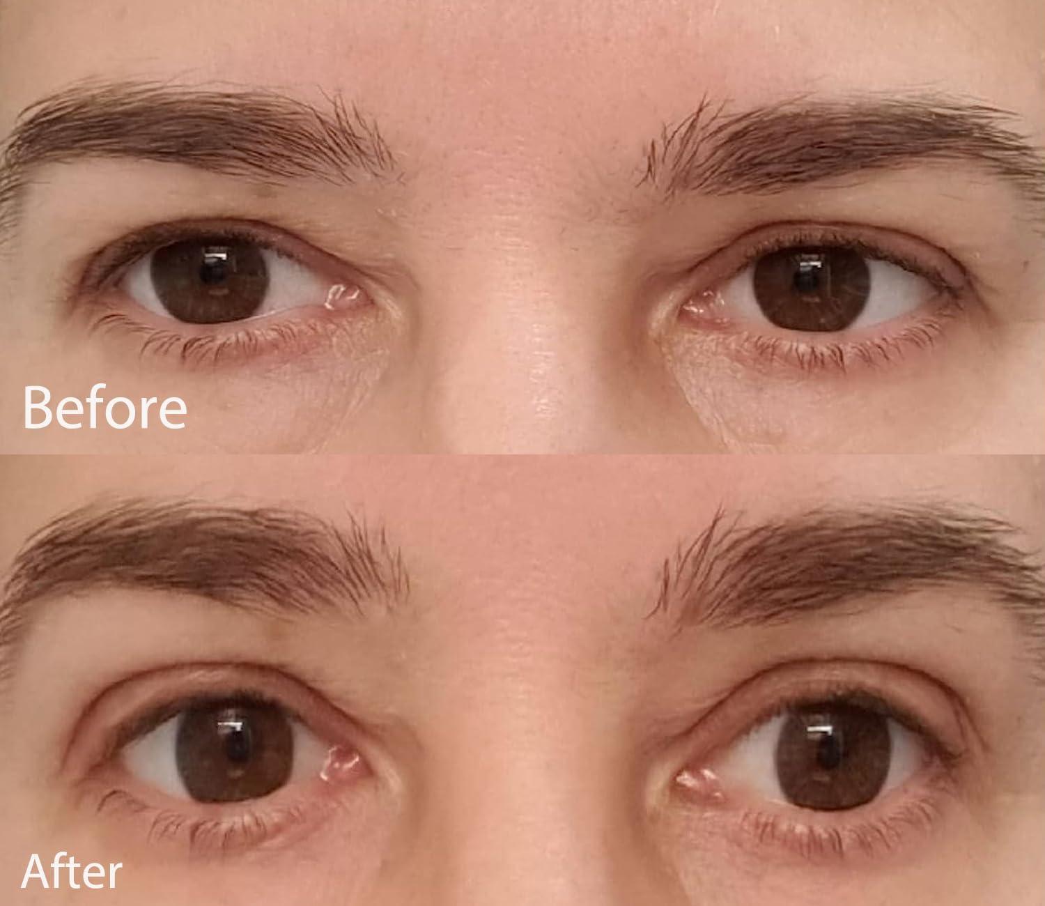 240Count x 7MM Invisible Eyelid Tapes Stickers Self-adhesive Fiber ...