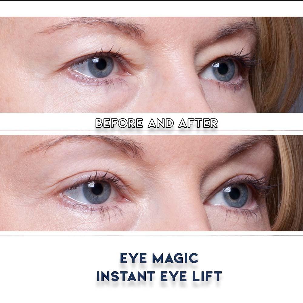Eye Magic Instant Eyelid Lift | Youthful Look | SM Kit wGel - Made in ...