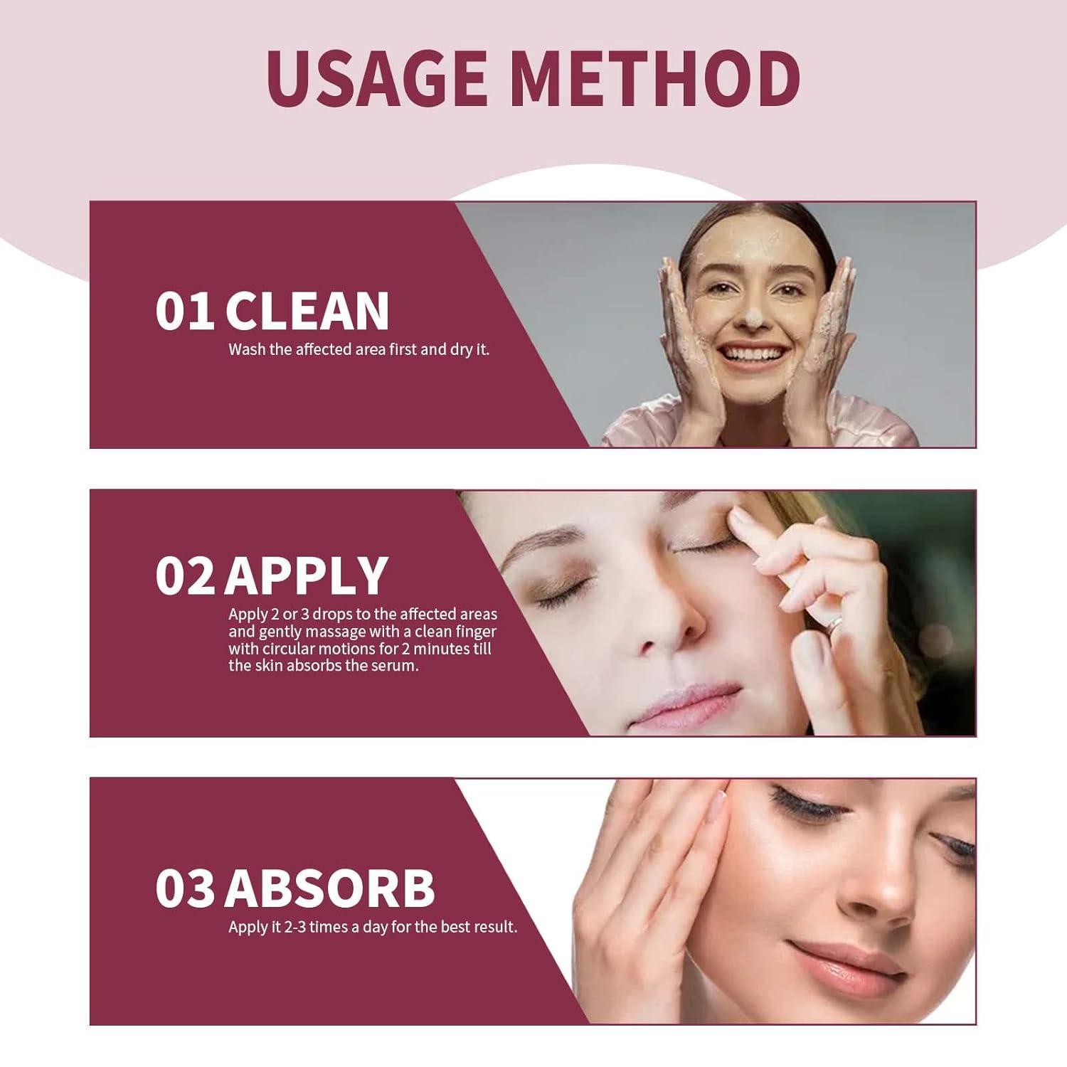 Stye Eye Treatment Serum - Fast Relief for Styes, Chalazion ...