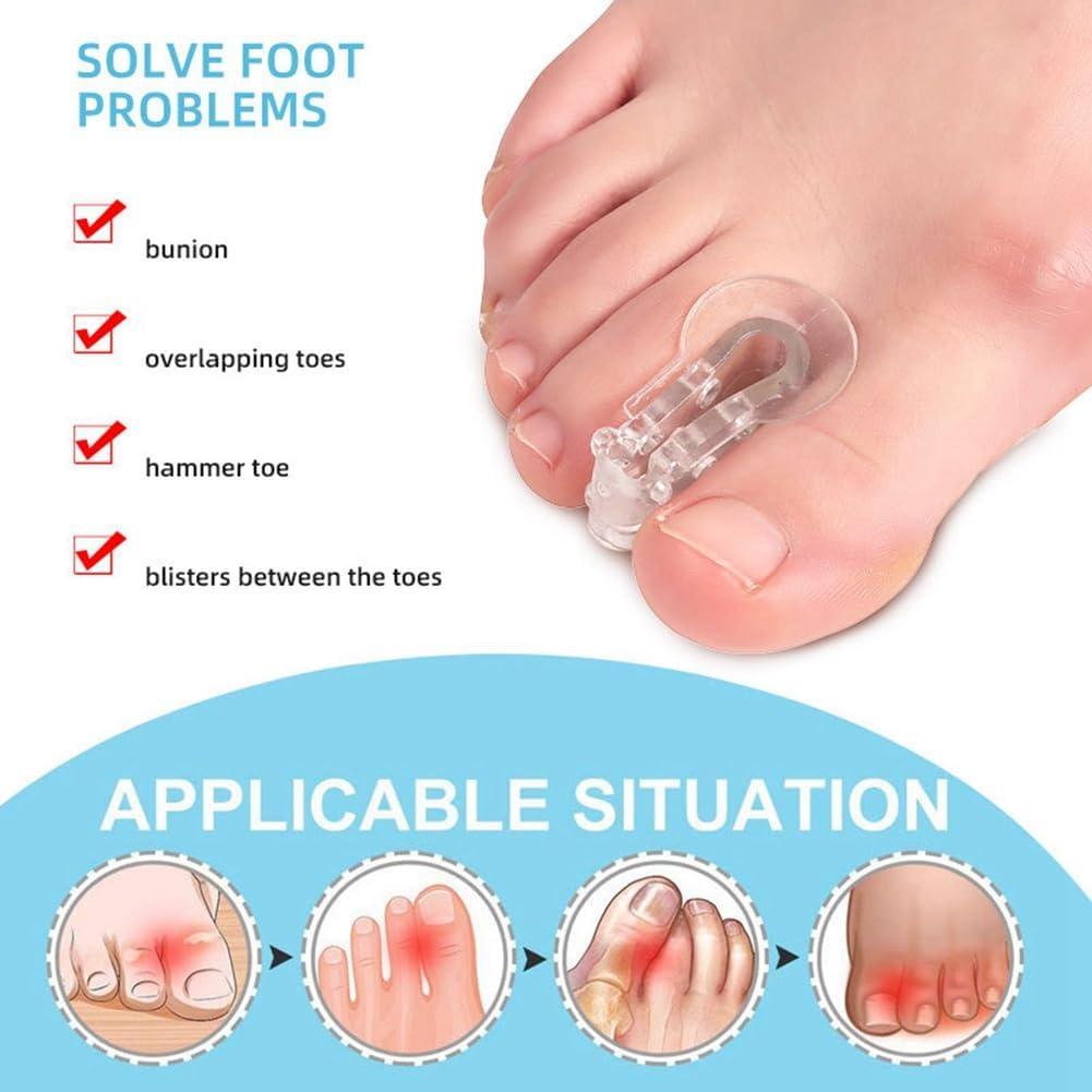 Citywalk Toe Spreader - 10 Durable Gel Orthoses for Hallux Valgus ...