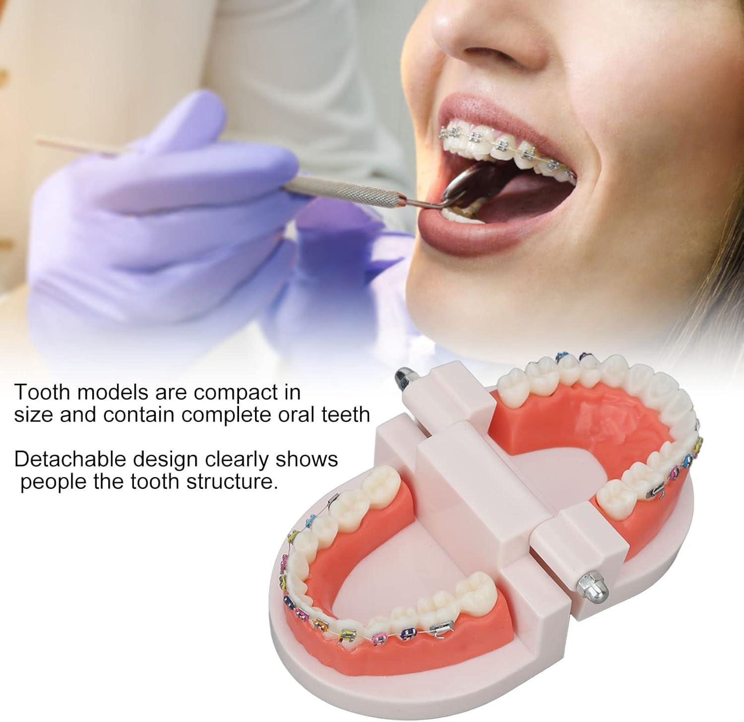 Orthodontic Tooth Model with Metal Brackets - Ideal for Teaching ...