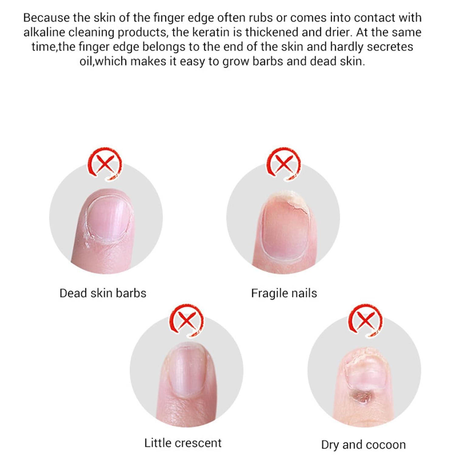 finger cuticle