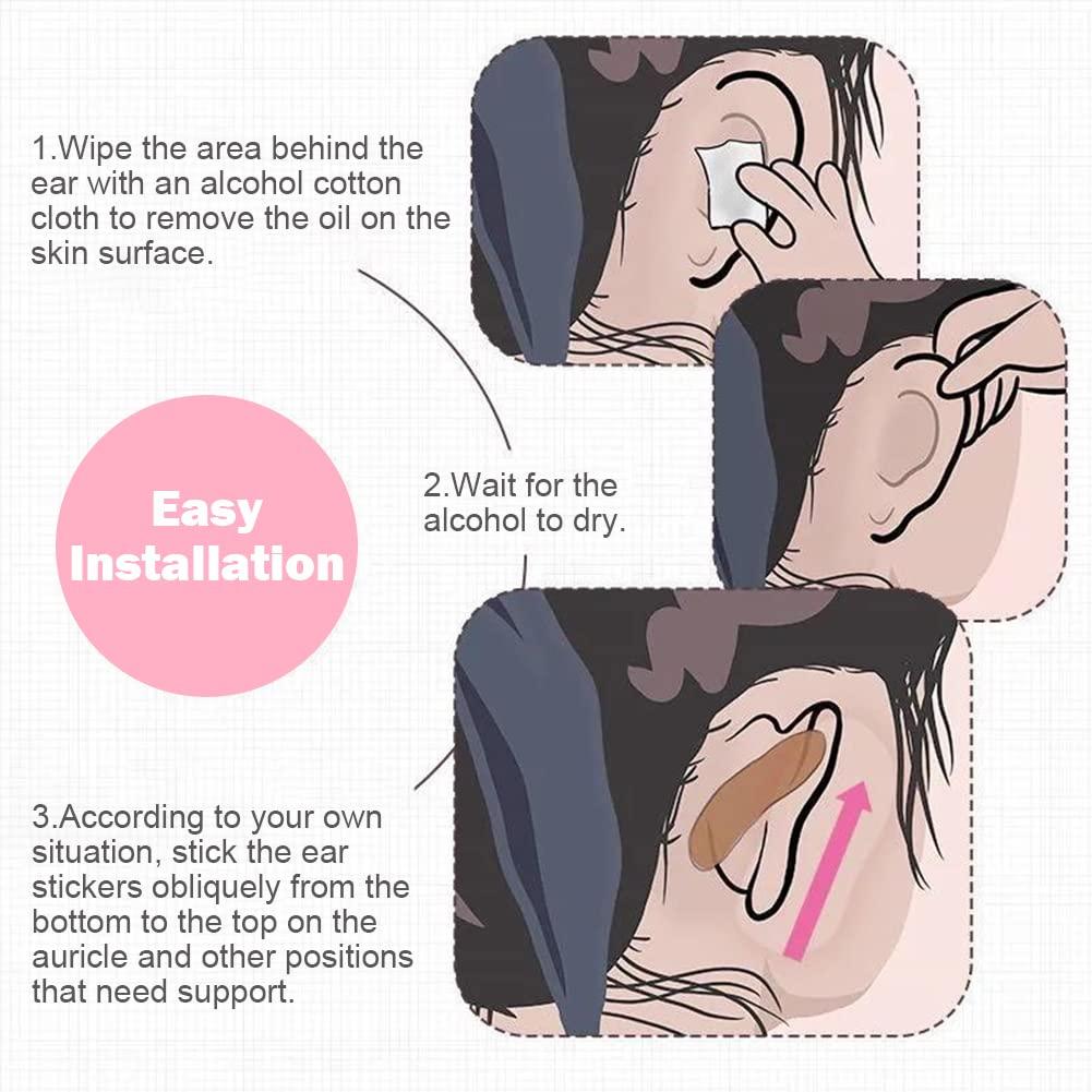 Buy Silicone Ear Correction Stickers - 30 Self-Adhesive Solutions for ...