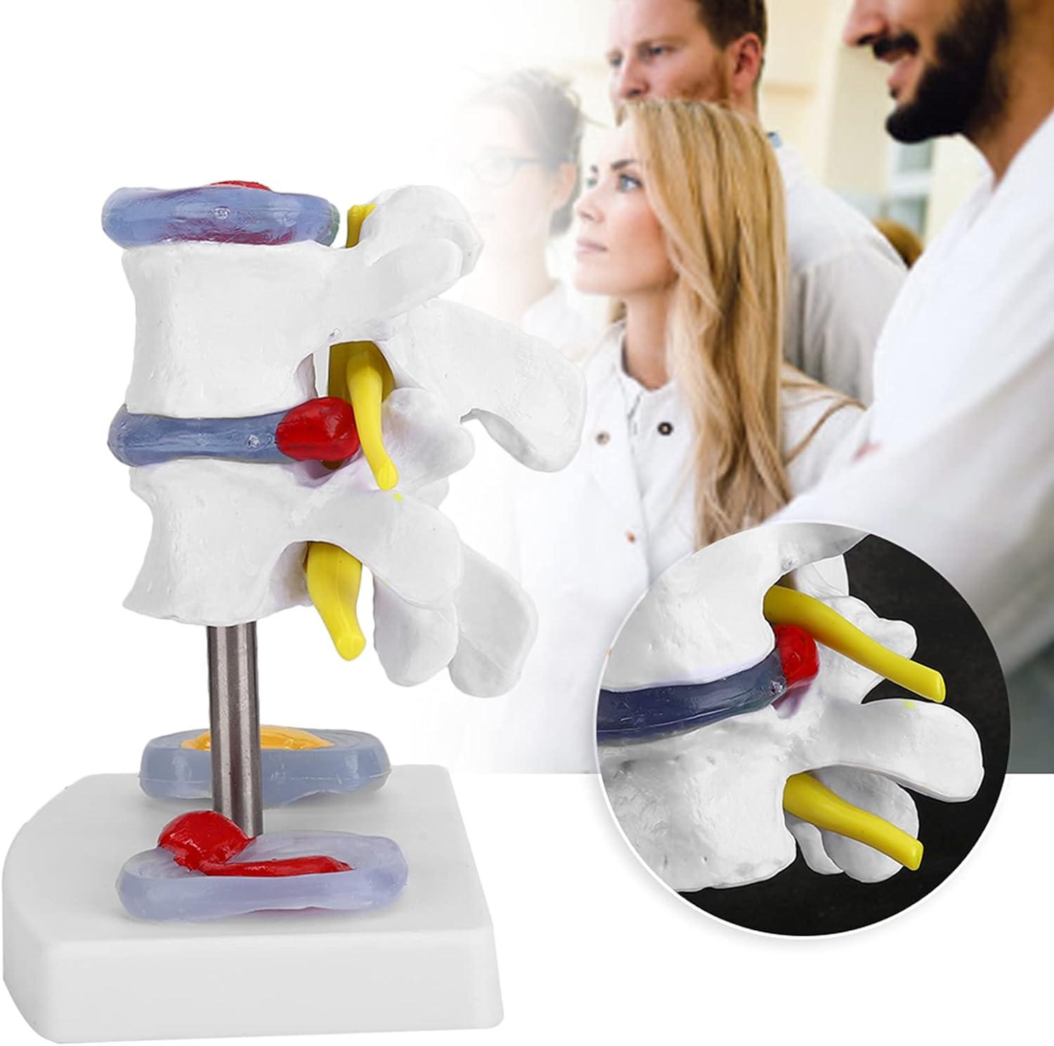 Anatomical Lumbar Intervertebral Disc Model - Spine Demonstration for ...