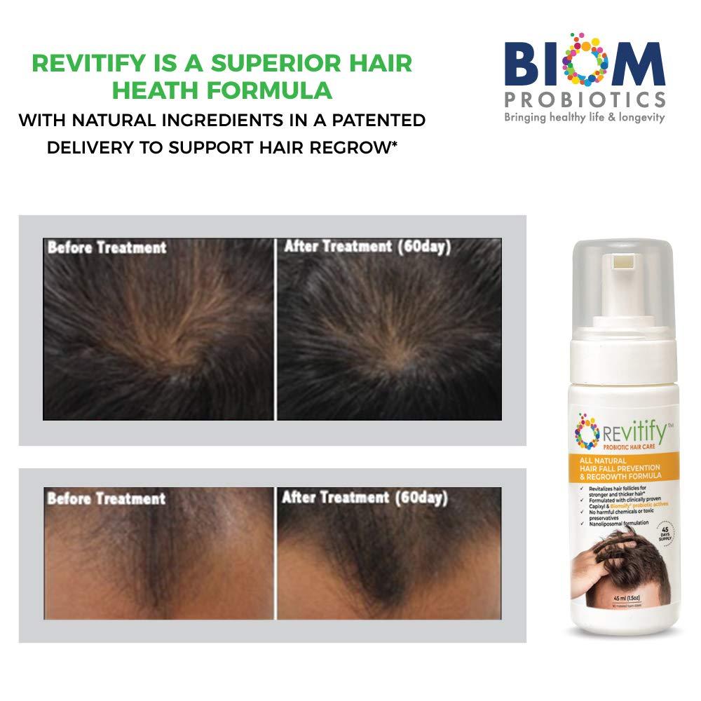 Revitify Probiotic Hair Growth Serum - Blocks DHT and Revives Follicle ...