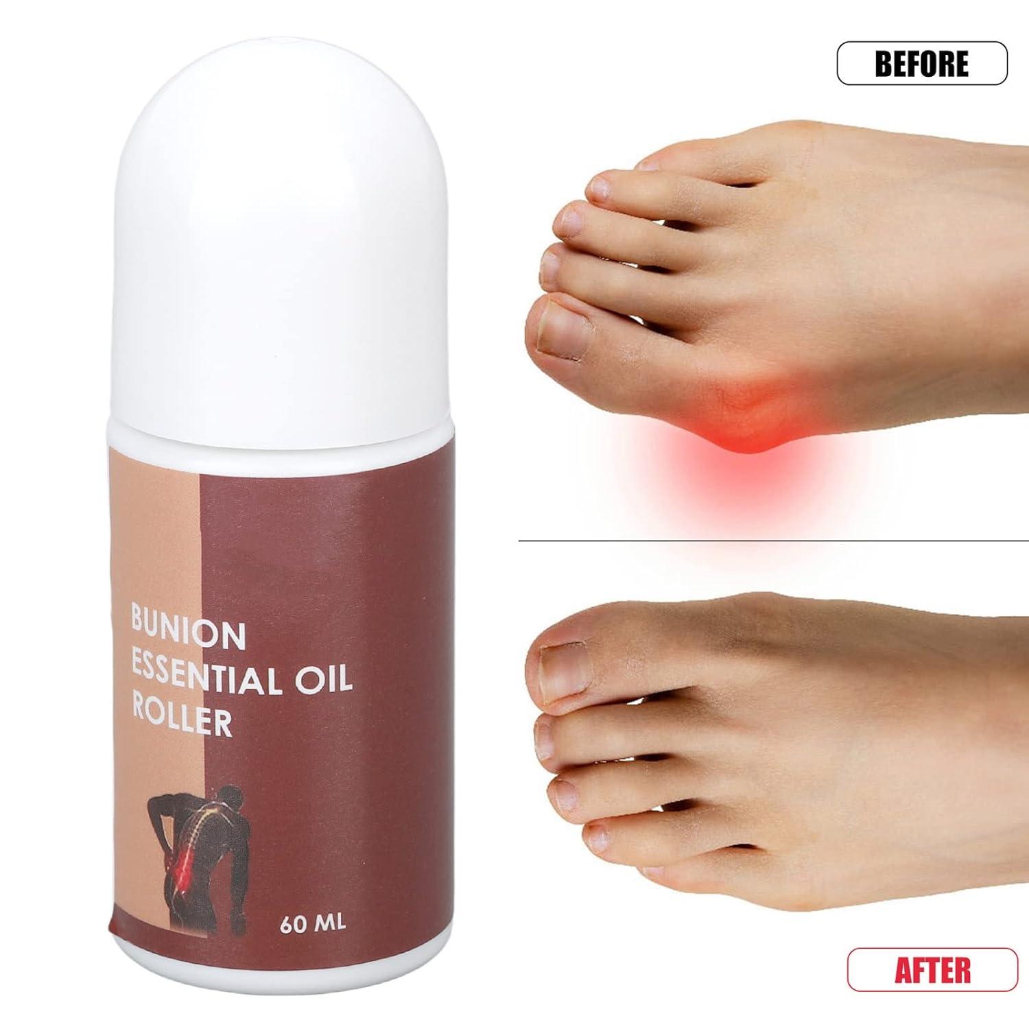 Essential Toenail Oil 60ml - Rapid Relief for Swelling & Discomfort ...