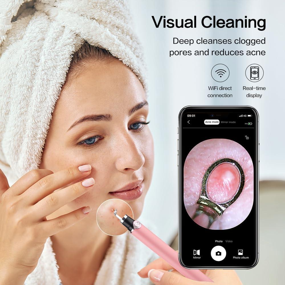 Blackhead Remover Tools Visible Pimple Popper Extractor Tool Kit with ...