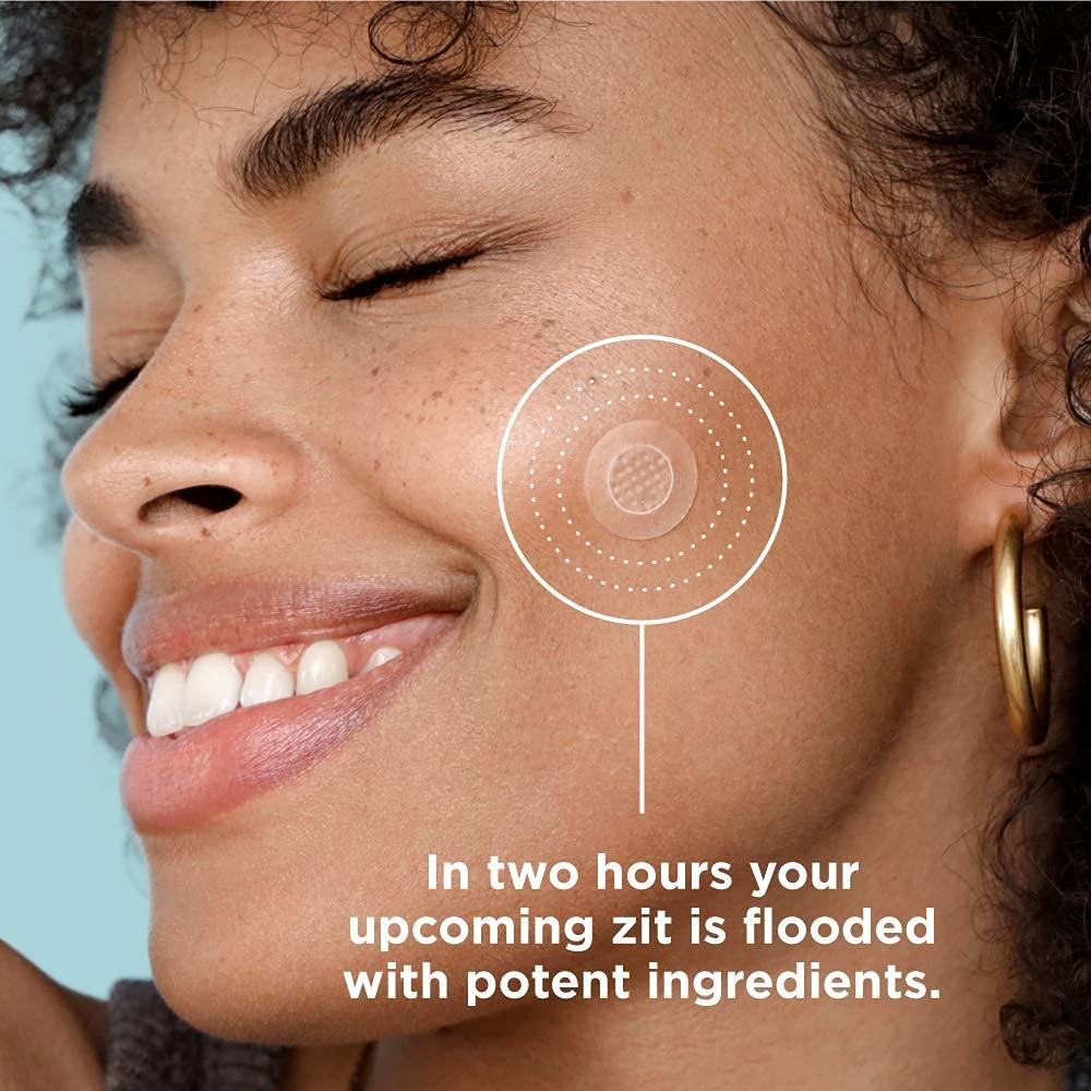 ZitSticka Killa Kit | Self-Dissolving Microdart Acne Pimple Patch for ...