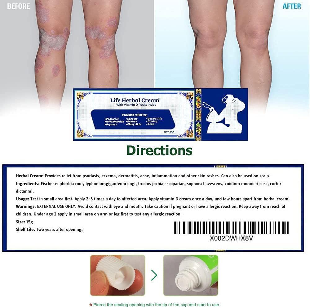 Life Herbal Cream with Vitamin D Packs Skin Relief Itch Inflammation ...