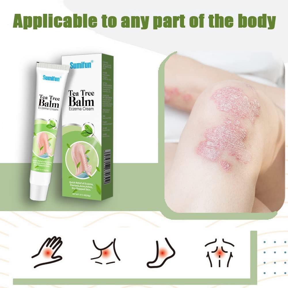 Tea Tree Oil Eczema Psoriasis Cream - Natural Anti-Itch Lotion for Dry ...