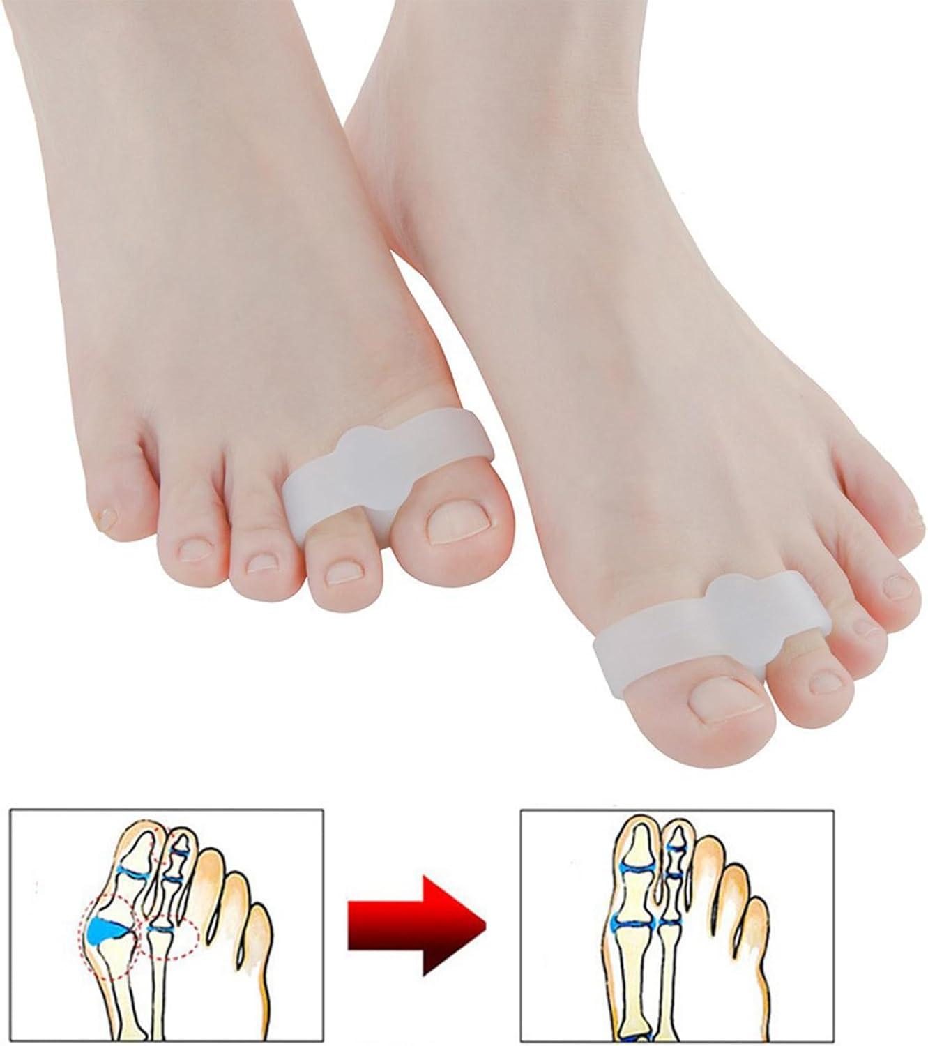 Lovemetoo Toe Spacers Silicone Orthotic Toe Spreaders for Hammer Toe ...