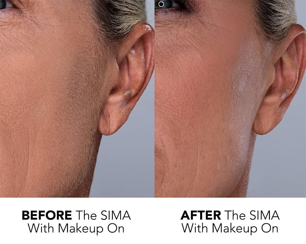 Spa Sciences SIMA Dermaplaning Tool - 2-in-1 Facial Exfoliation & Hair Removal System ...