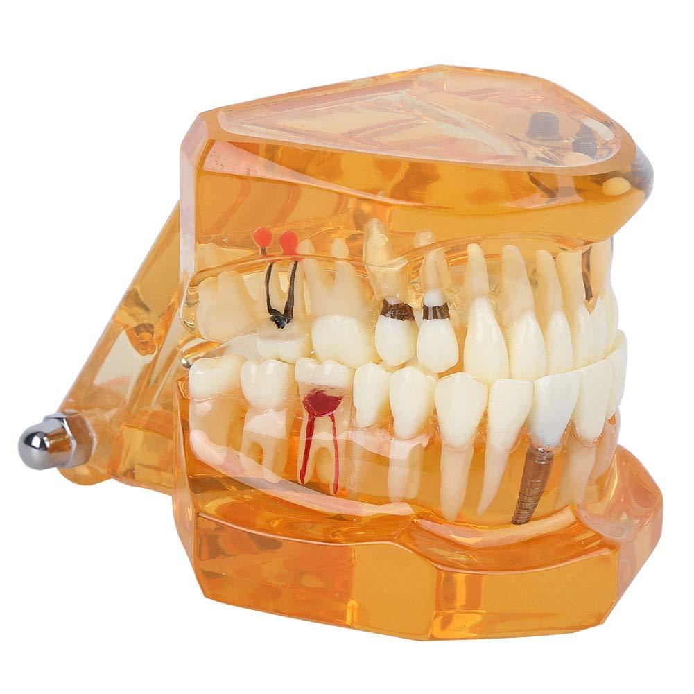 Standard Tooth Model - Removable Dental Teaching Materials for Kids ...