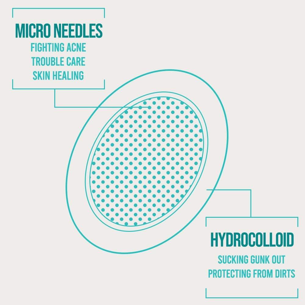 Patch Pro Micro Needle Patch for Pimple Treatment - 18pcs Microneedle ...