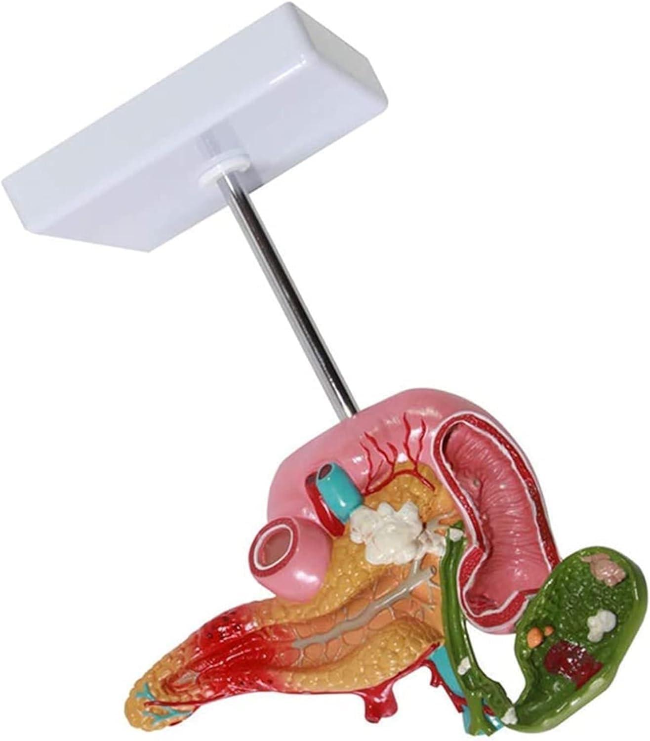Duodenal Biliary and Pancreatic Model - Duodenal Model - Gallbladder ...