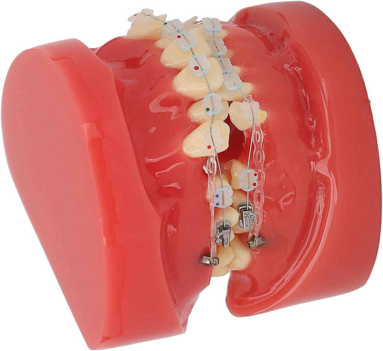 Orthodontic Model 24 Teeth with Metal Wire Case - Ideal for Dental ...