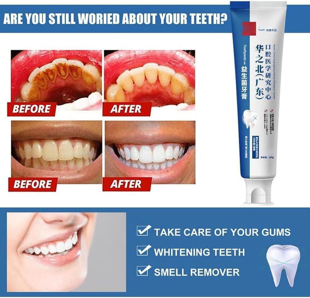Japanese Probiotic Tooth Whitening Toothpaste - Stain Removal & Plaque ...