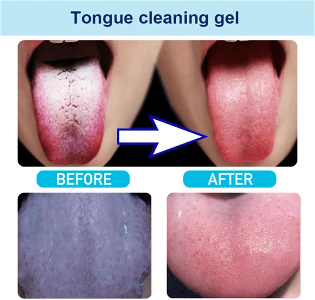 Donubiiu Probiotic Tongue Cleaning Gel Set - Oral Hygiene Brush & Mint ...