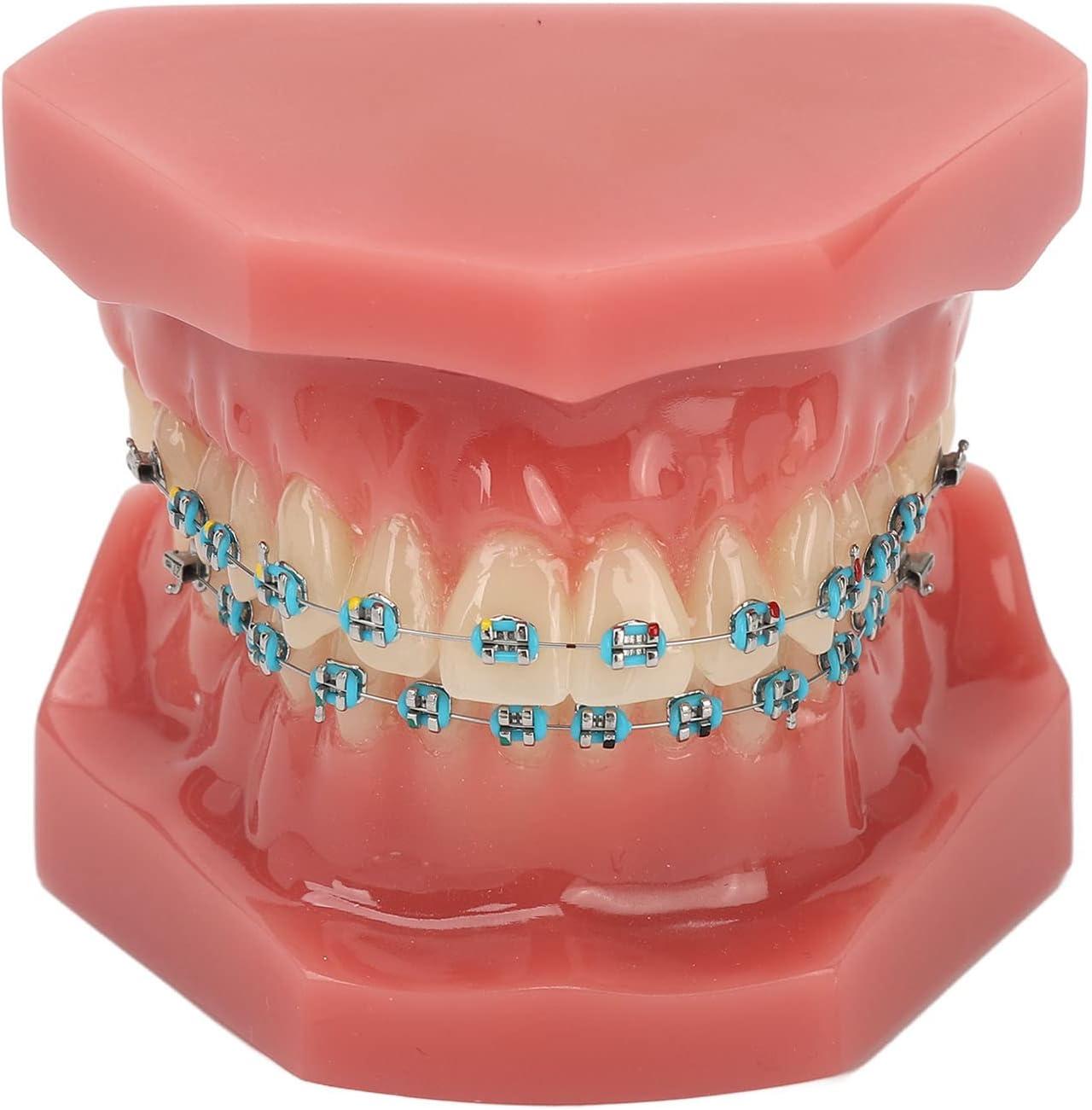 Orthodontic Model | 28 Partial Dental Resin Demonstration & Bracket ...
